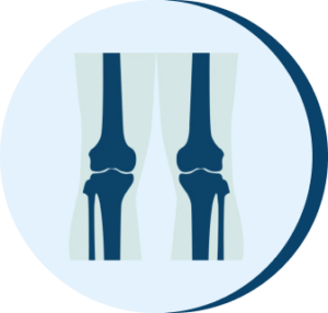 OrthoNeuro | Top Orthopedic Surgeons in Columbus, Ohio